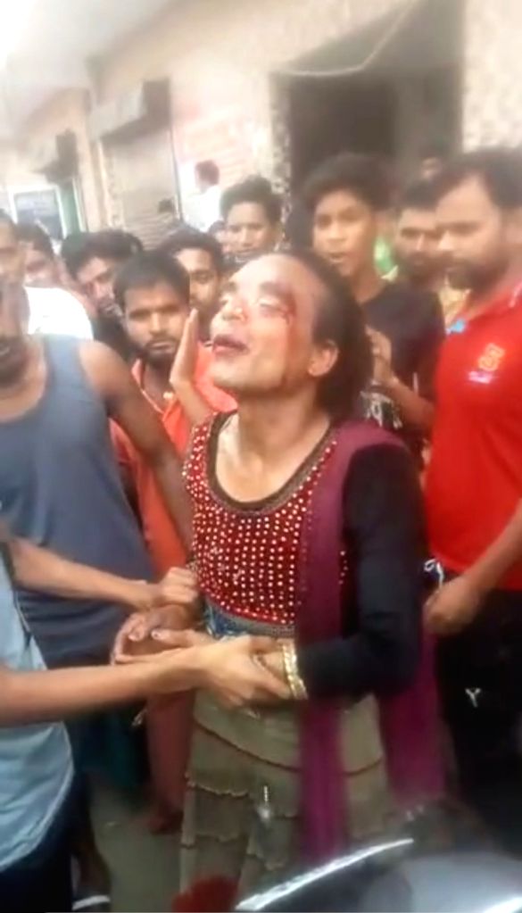 Free Photo: Bahrupia was badly beaten up on suspicion of child theft, 4 ...