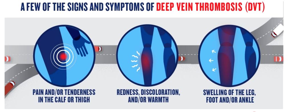 Debunking myths about Thrombosis
