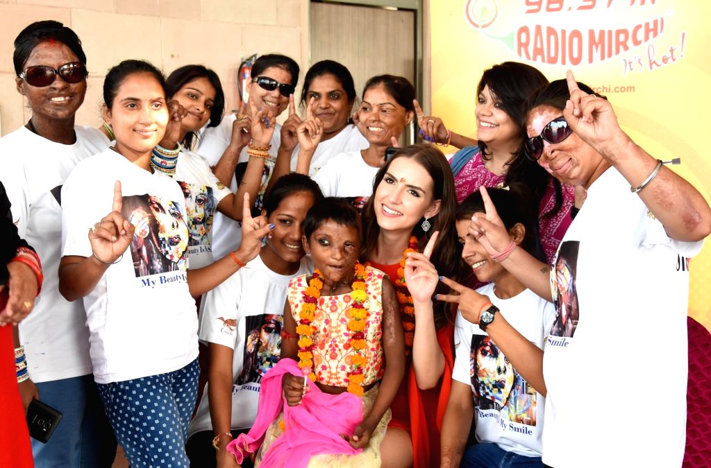 Anna Burdzy meets acid attack survivors at Sheroes' Hangout
