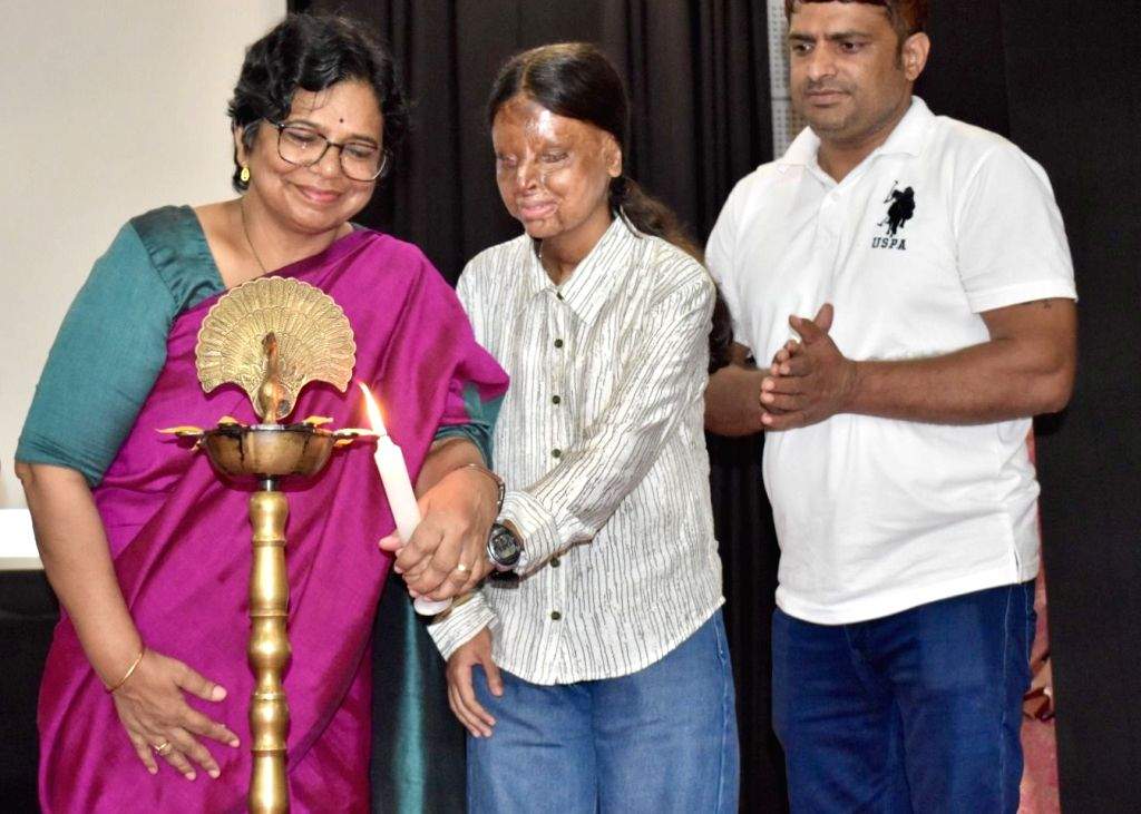 NCW Honours Acid Attack Survivor “Kafi”