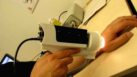 Camera that detects skin cancer in two seconds!