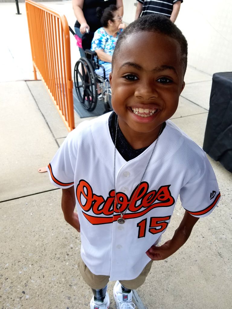 World's first kid with double hand transplant now plays baseball